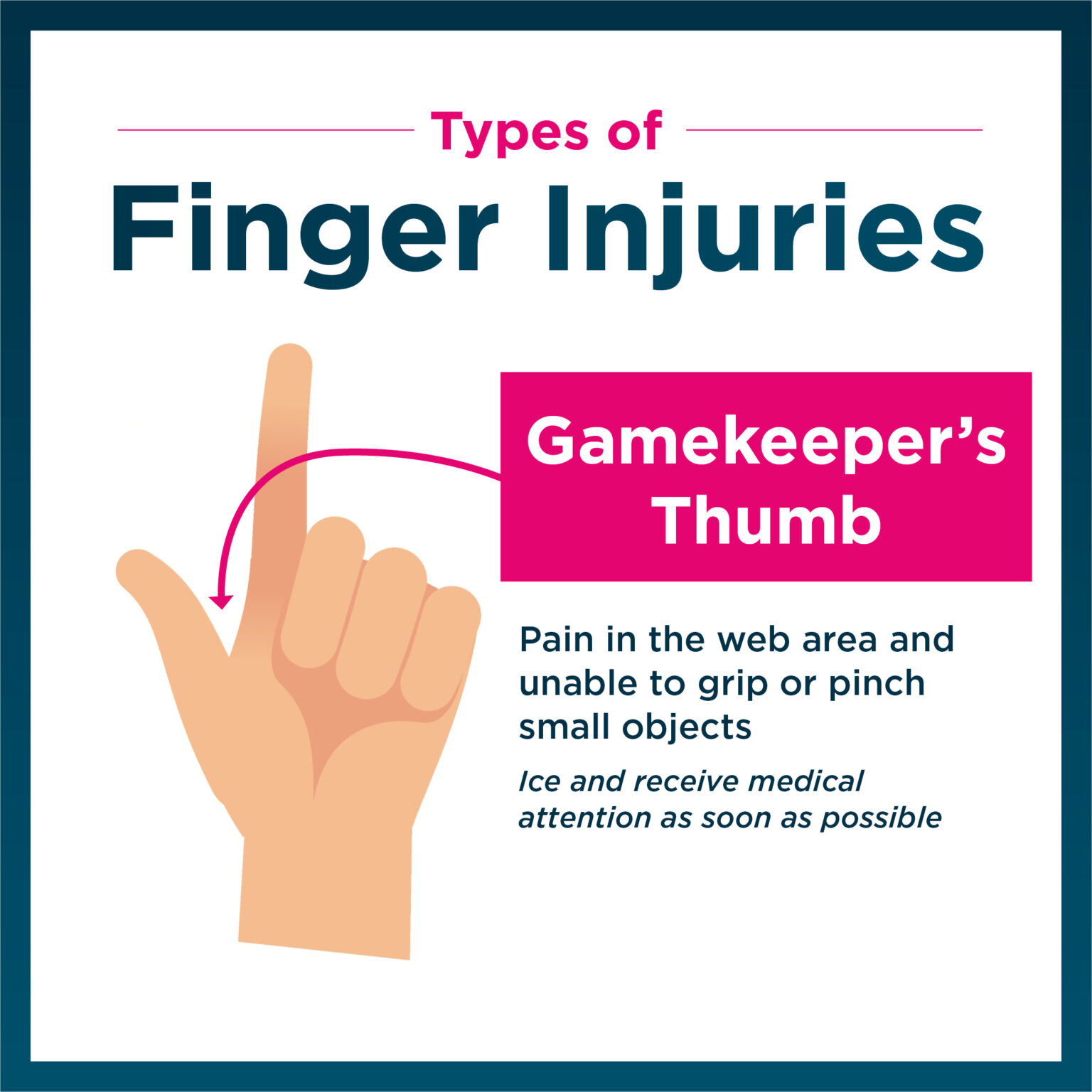 Common finger injuries: Simple strains to dislocations | Shine365