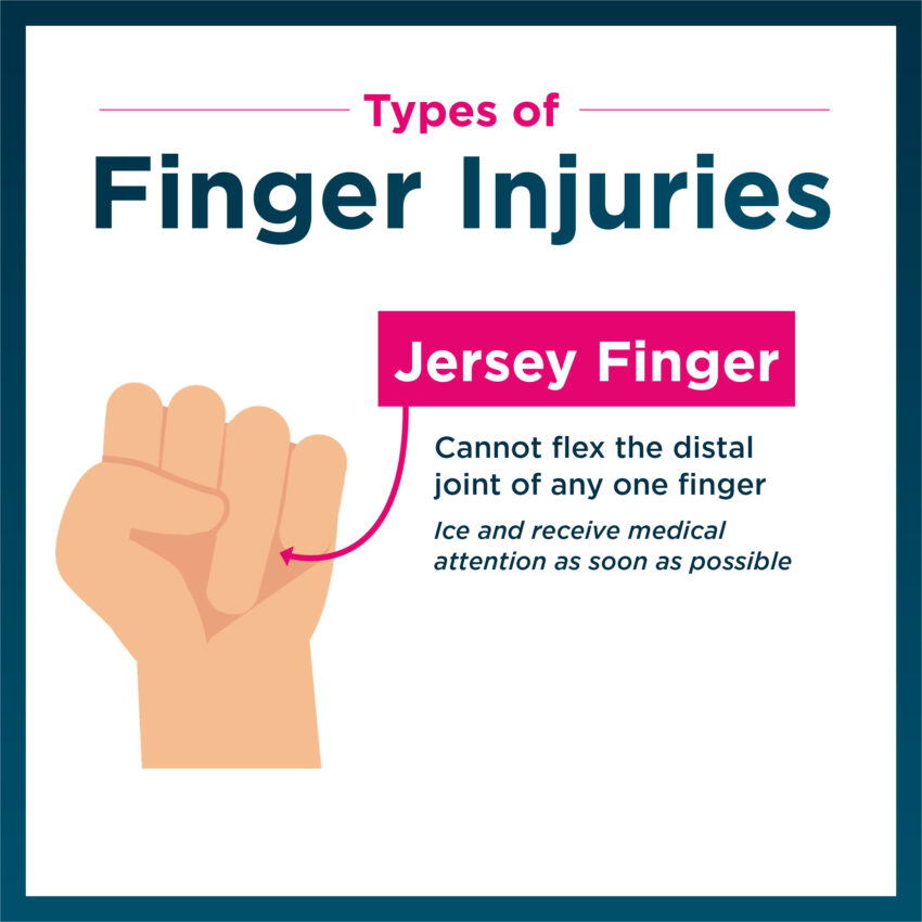 Common finger injuries: Simple strains to dislocations | Shine365