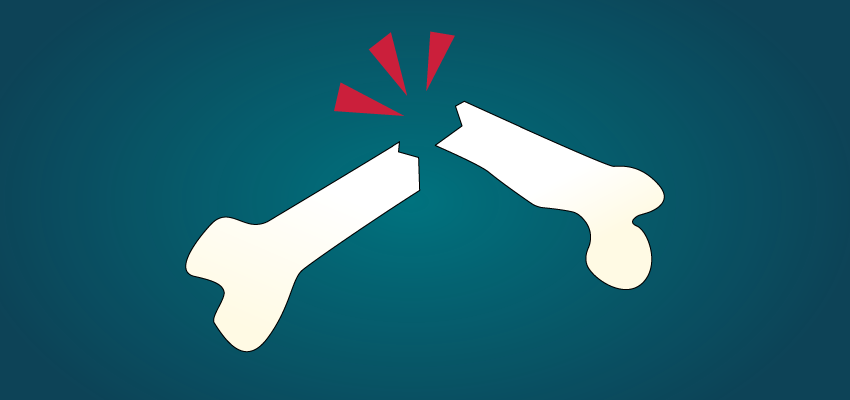 Types of bone fractures: How to tell if it's broken