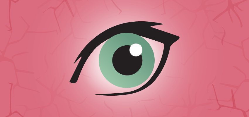Pink eye? Understanding conjunctivitis symptoms | Shine365