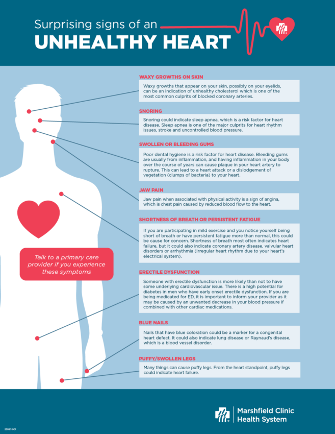 Surprising signs of an unhealthy heart | Shine365 from Marshfield Clinic